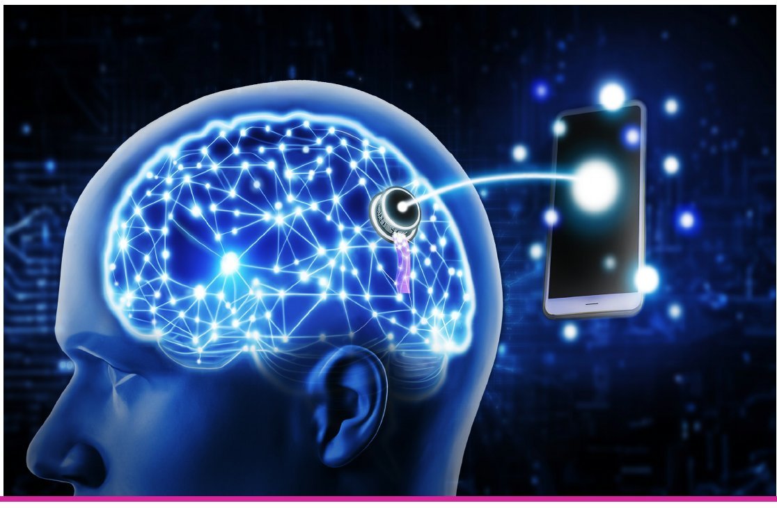 Commercializing Brain-computer Interfaces – Trends (audiotech)